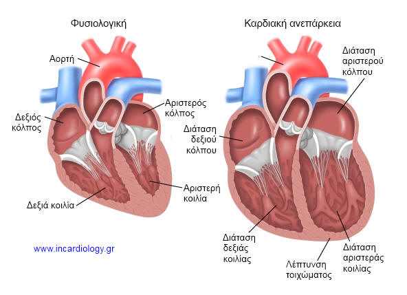 Τσιαντής Νικ. Ιωάννης, MD, MSc | ΚΑΡΔΙΑΚΗ ΑΝΕΠΑΡΚΕΙΑ